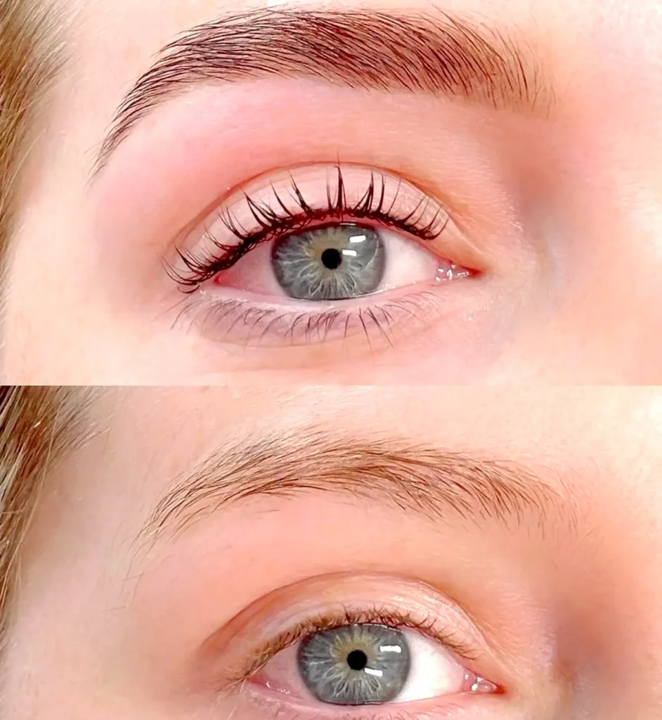 Can You Reshape Eyebrows Permanently?